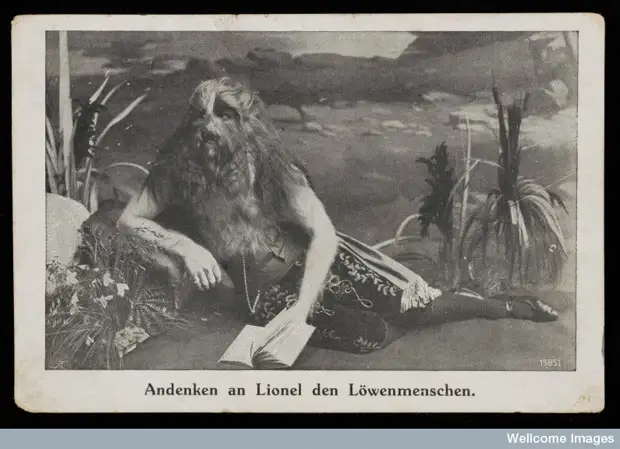 Волосатые люди и их судьба - ПолонСил.ру - социальная сеть здоровья ...